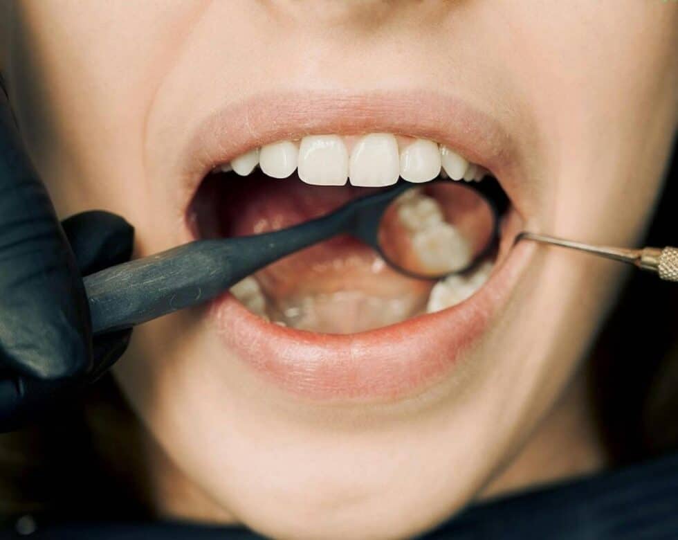 Treatment and Prevention of Dry Mouth in Ladysmith, BC - Ladysmith ...